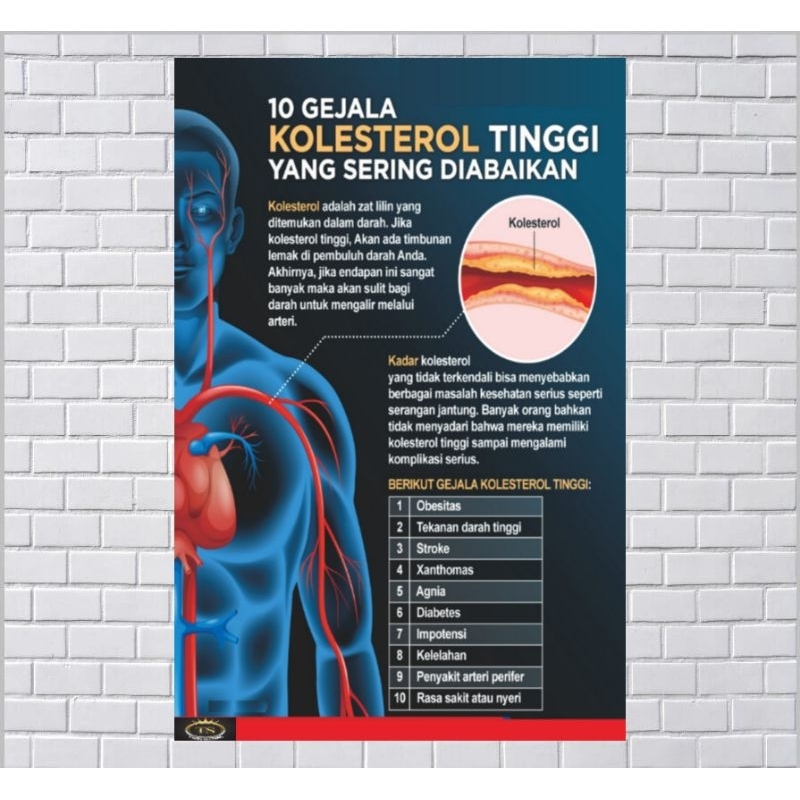 Jual Poster Kesehatan 10 Gejala Kolesterol Tinggi Yang Sering Di ...
