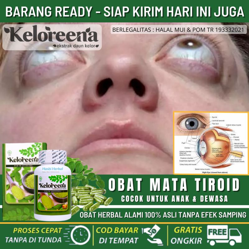 Jual Obat Bola Mata Menonjol Secara Abnormal Pada Anak & Dewasa, Jamu ...