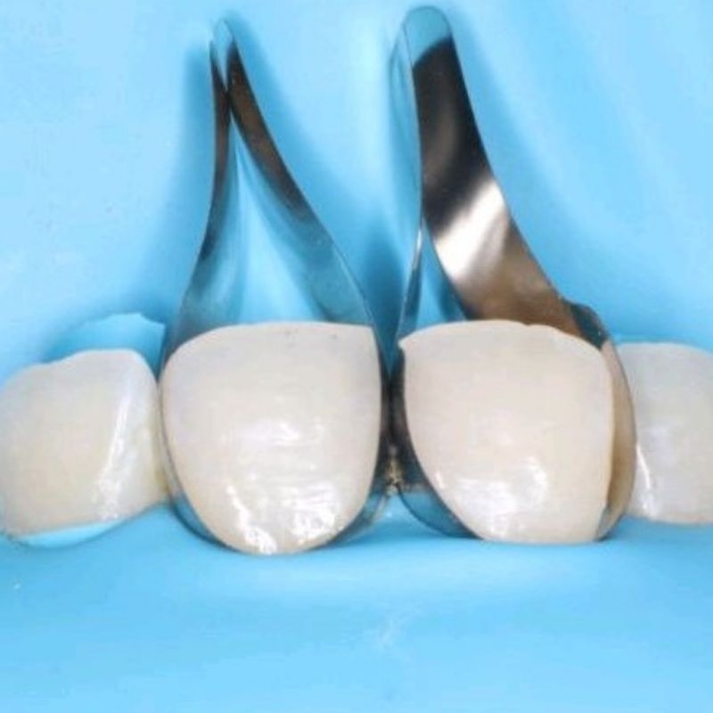 Jual ORIGINAL TOR VM Matrix Anterior Twin | Matrix Veneer | Unica ...