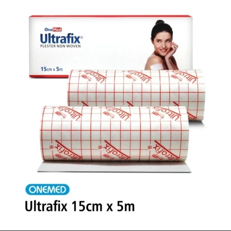 Jual Ultrafix 15 cm x 5 m onemed medical tapes non woven | Shopee Indonesia