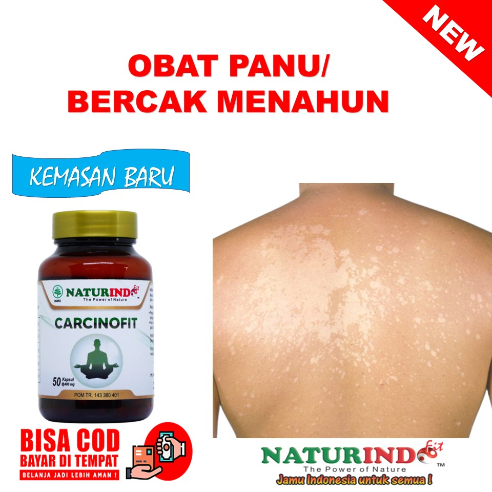Jual OBAT PANU BERCAK PUTIH KADAS KURAP PANU HITAM GATAL GATAL EXSIM ...