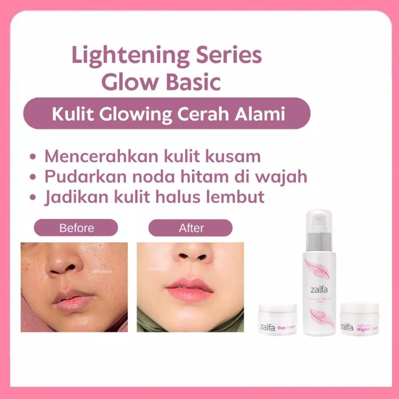 Jual zalfa Natural Skincare Paket lightening series | Shopee Indonesia