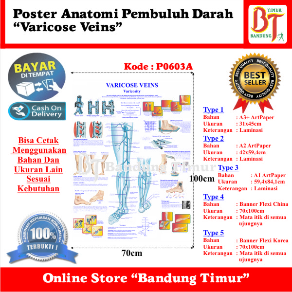 Jual POSTER ANATOMI PEMBULUH DARAH - VARICOSE VEINS | Shopee Indonesia