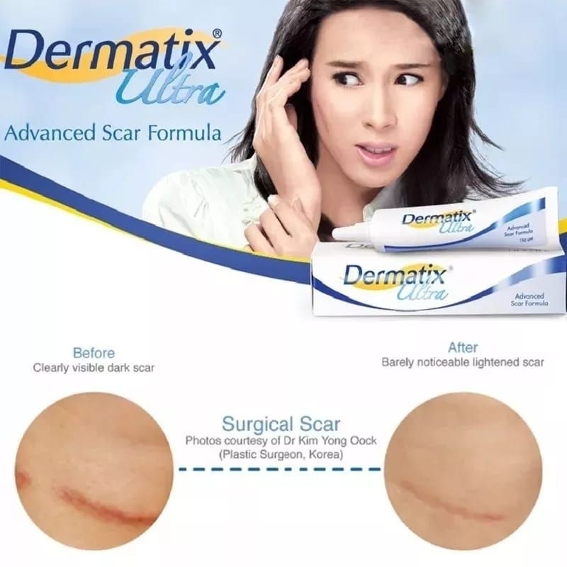 Jual Dermatix ultra Advanced 15gr Cream Penghilang Bekas Luka 15gr ...