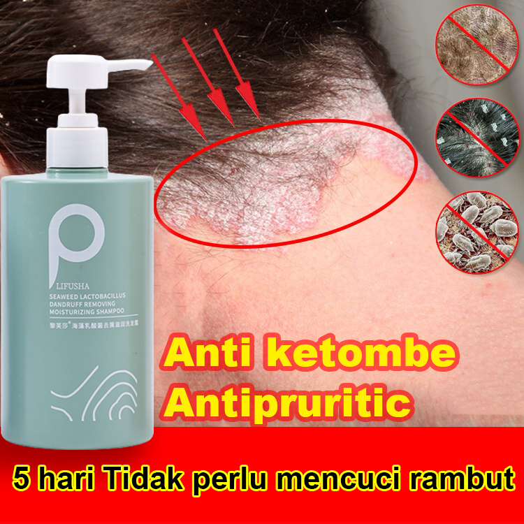 Jual shampoo anti ketombe dan rontok 500ml Anti Gatal perawatan rambut ketombe Garam Laut ...