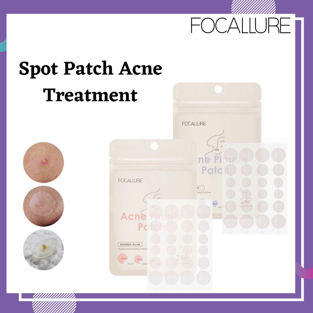 Jual Focallure Spot Acne Patch Treatment Day/Night Waterproof Smooth ...