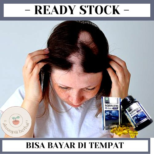 Jual Obat Alopecia Areata, Pitak, Obat Kepala Botak, Obat Rambut Rontok, Obat Penumbuh Rambut ...