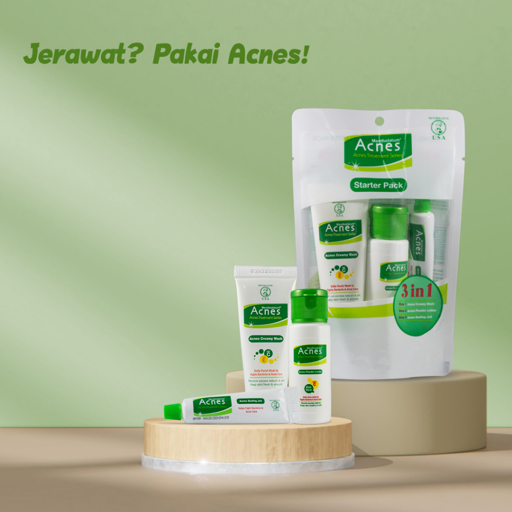 Jual Acnes Treatment Series Starter Pack 3 in 1 | Shopee Indonesia
