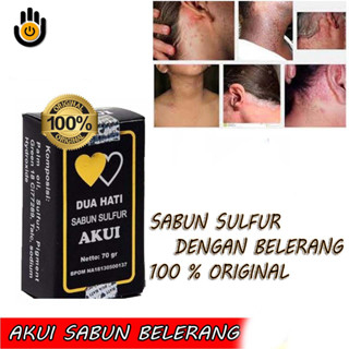 Jual Sabun Gatal AKUI Sulfur Belerang /Sabun Obat Gatal Kurap Kudis ...