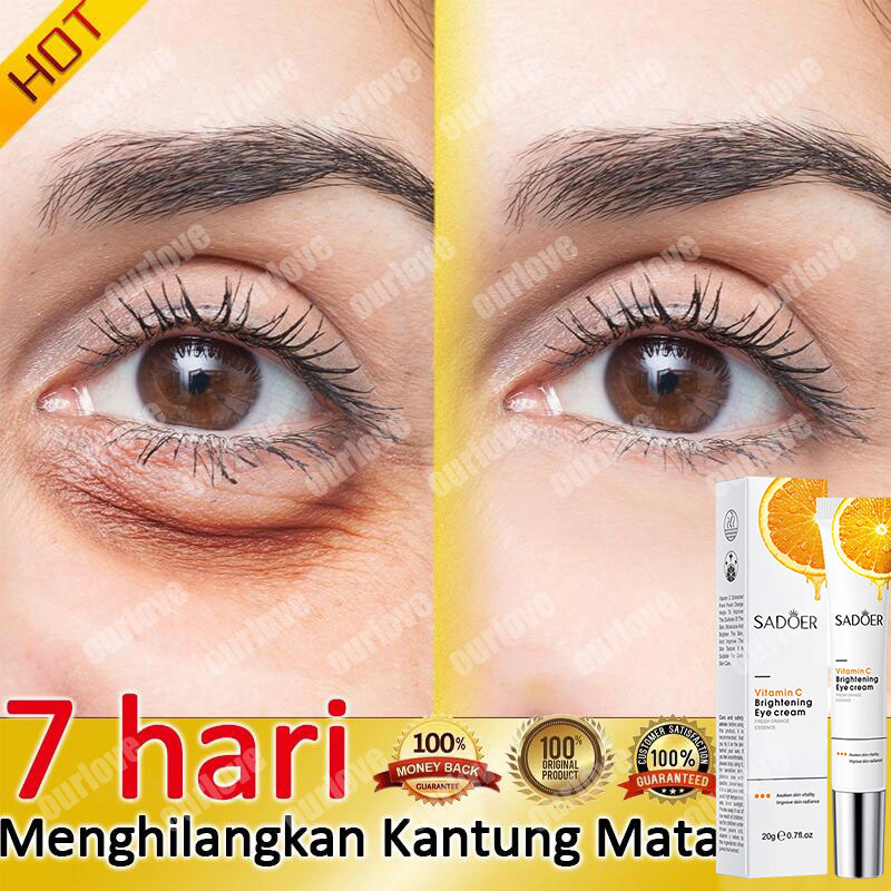 Jual Vitamin C Eye Cream Anti Aging menghilangkan milia menghilangkan ...
