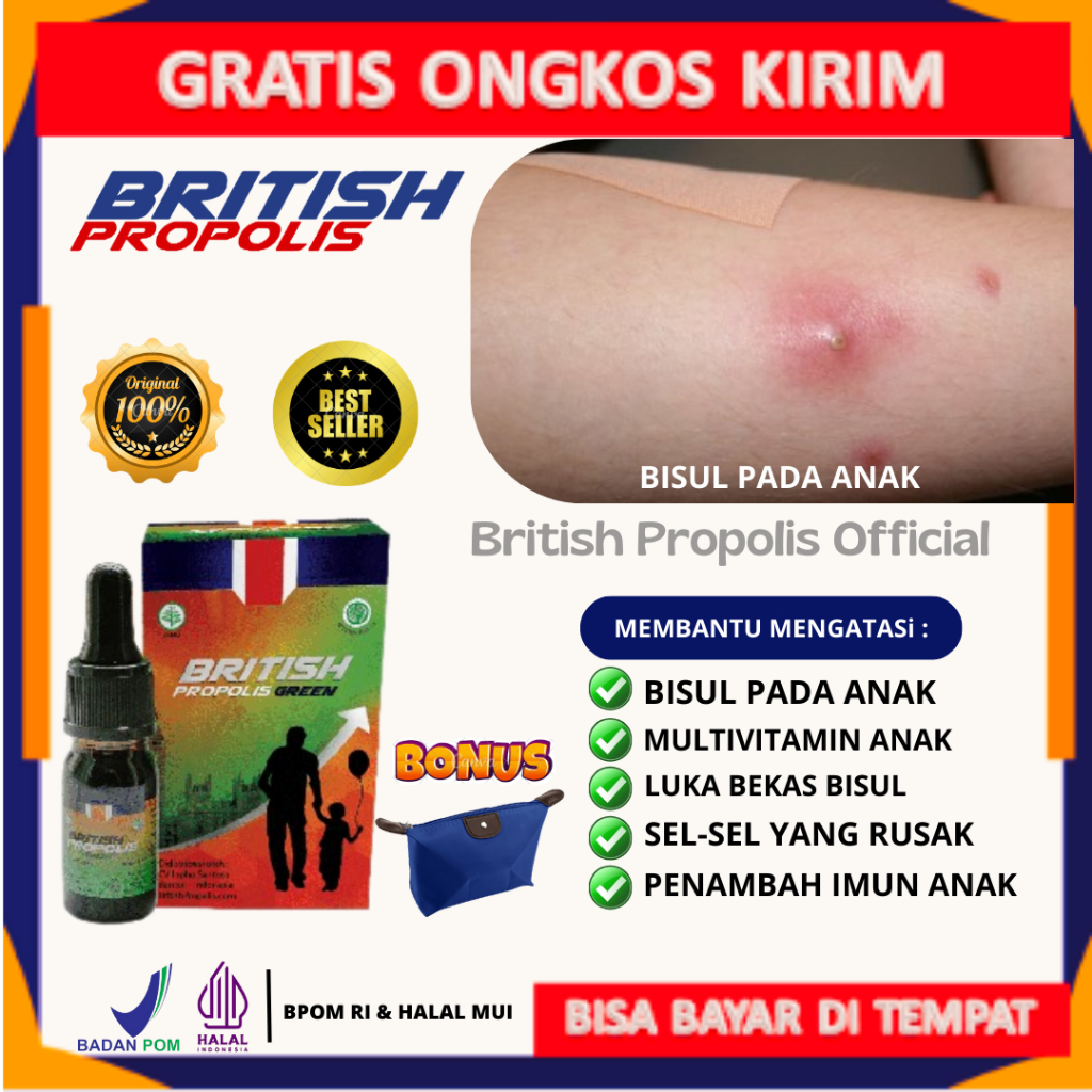 Jual British Propolis Green - Obat Herbal Bisul Pada Anak, Luka Bekas ...