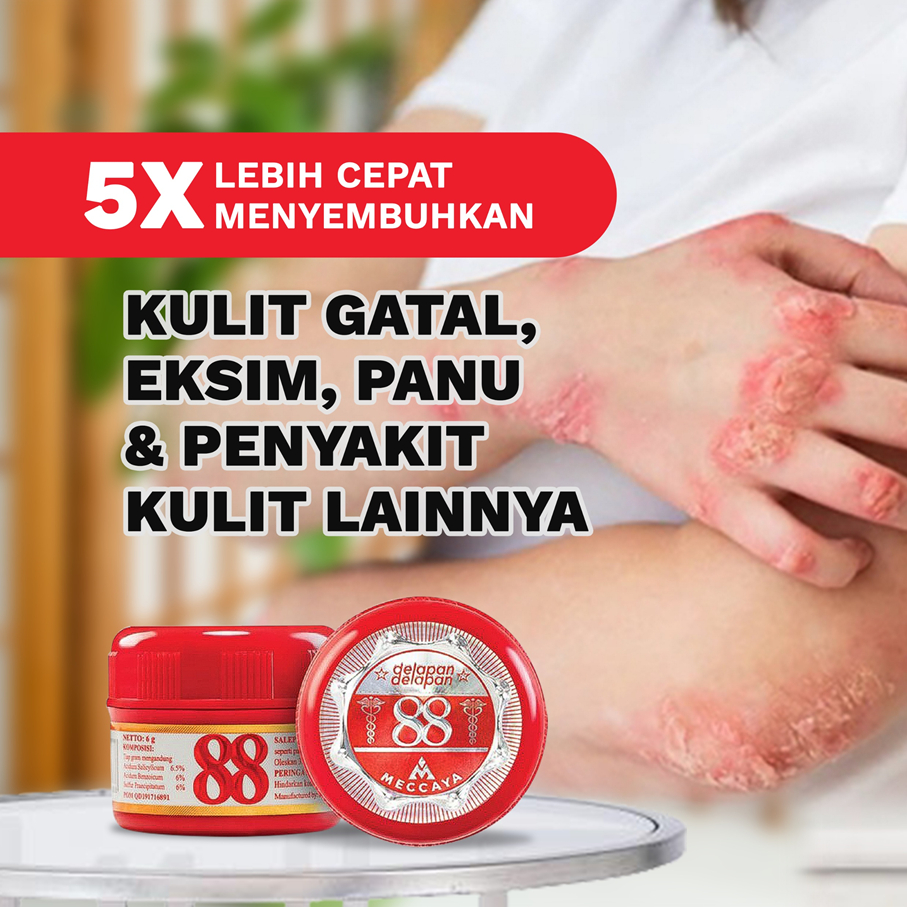 Jual Obat Salep Eksim Kering Ampuh Basah Gatal Gatel Kulit Panu Kurap ...