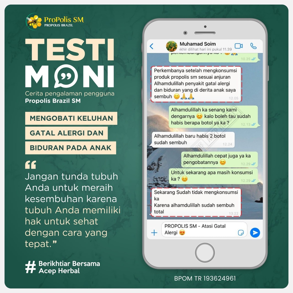 Jual Obat Tetes Gatal Bintik - Bintik Air di Tangan, Obat Gatal ...