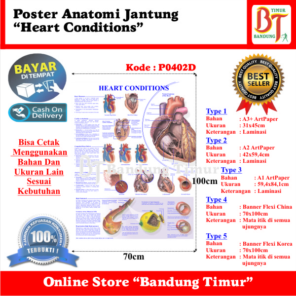 Jual POSTER ANATOMI JANTUNG - HEART CONDITIONS | Shopee Indonesia