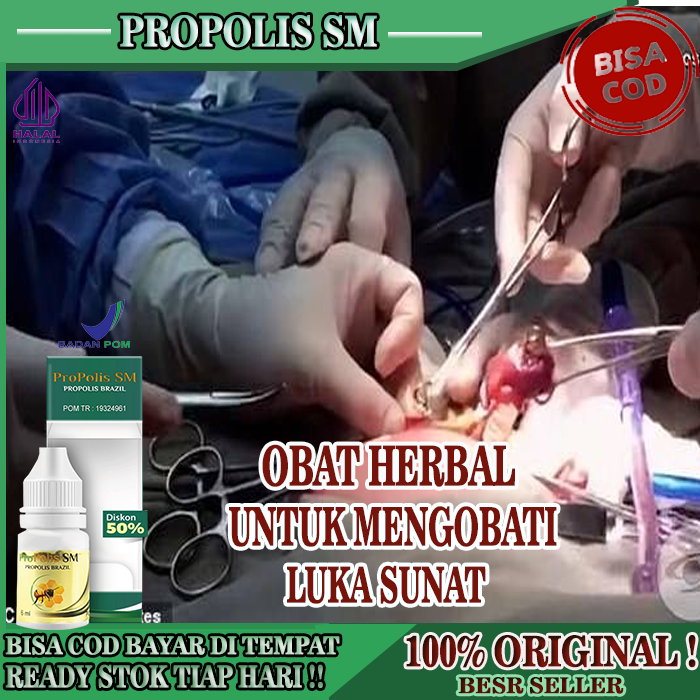 Jual Obat Untuk Luka Sunat, Obat Oles Pengering Luka Habis Sunat ... Jual Obat Untuk Luka Sunat, Obat Oles Pengering Luka Habis Sunat ...