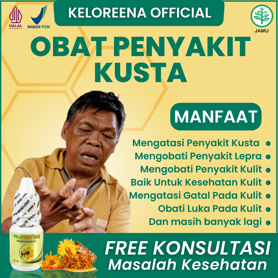 Jual Obat Kusta Herbal Penyakit Kulit Lepra Kering dan Basah Luka ...