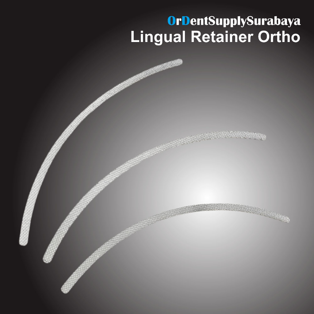 Jual Lingual Retainer Ortho/kawat gigi Retainer/splinting Orthodontic 2 ...