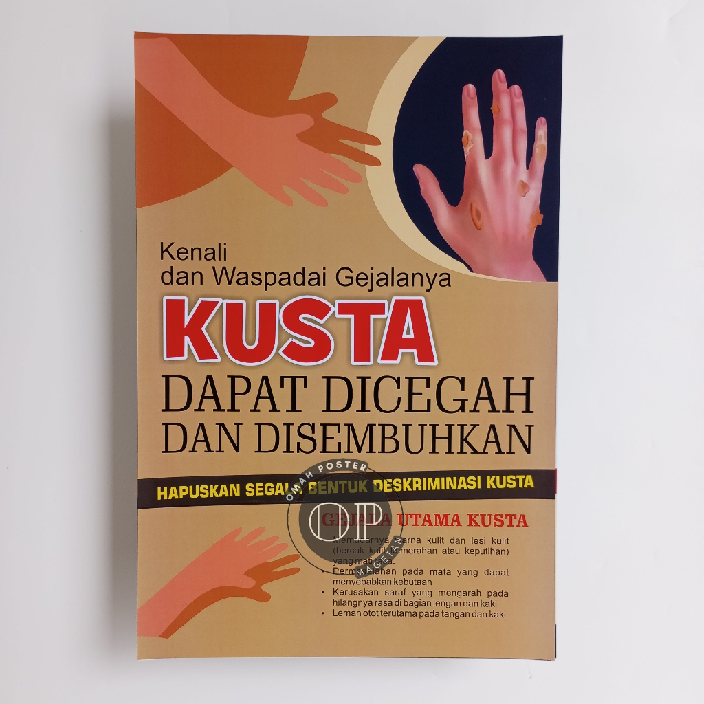 Jual Poster Kusta Dapat Dicegah dan Disembuhkan - Poster Kusta - Cegah ...