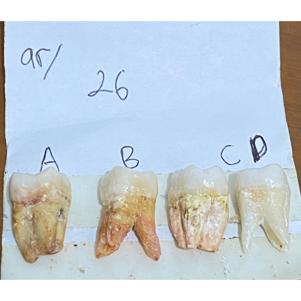 Jual GIGI MOLAR 1 RA 26 (GIGI PRAKTIUK FKG) | Shopee Indonesia