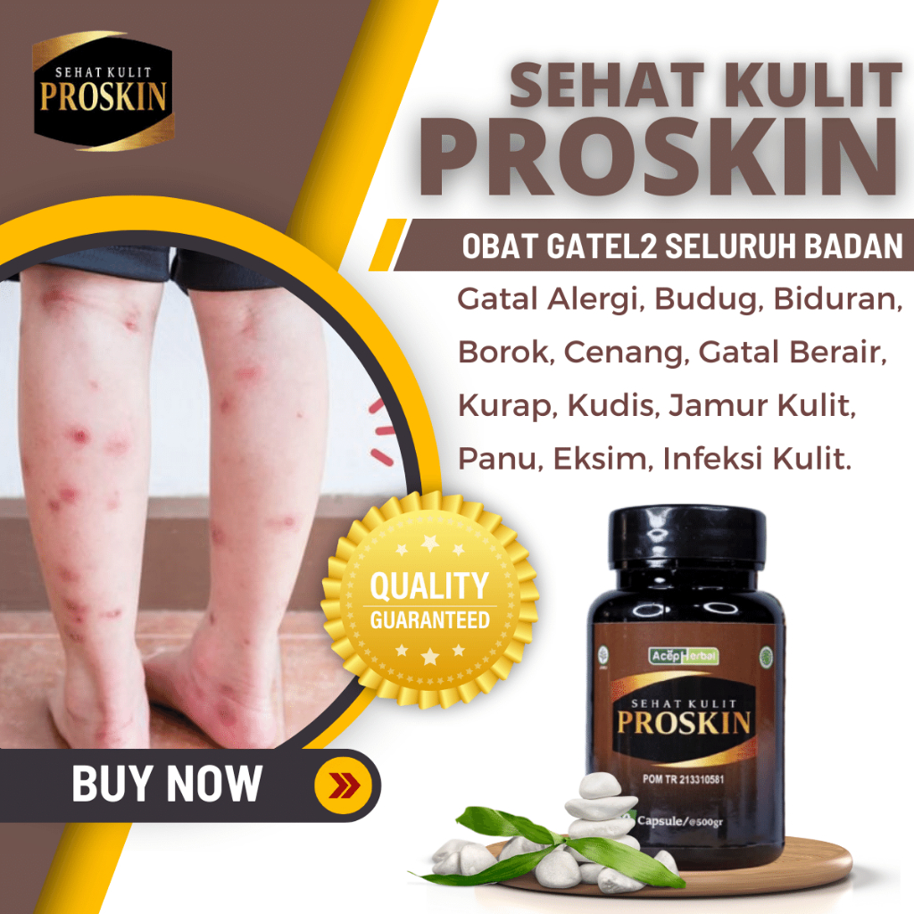 Jual Obat Budug Bernanah, Atasi Penyakit Santri, Gudik Scabies Manusia ...