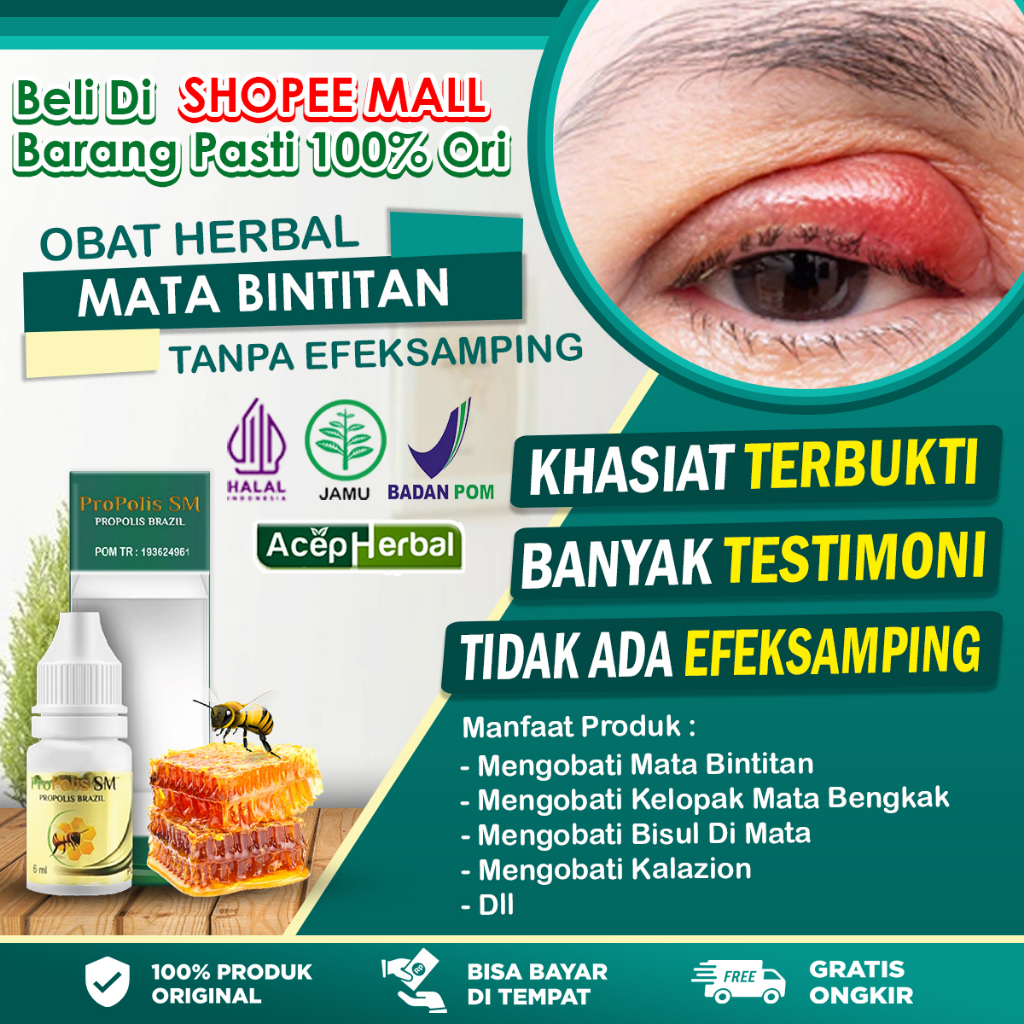 Jual Obat Mata Bintitan luar Penghilang Salep Mata Bintilan Mata ...
