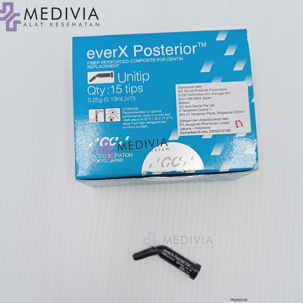 Jual GC EVERX EVER X ECER FIBER POSTERIOR COMPOSITE RESTORATION TIP ...