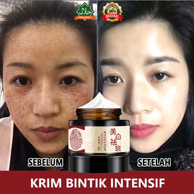 Jual Cream penghilang flek hitam Krim pemutih wajah Krim penghilang ...