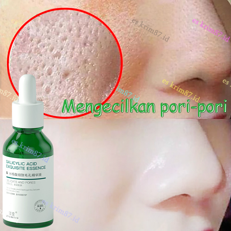 Jual Niacinamide Serum Salicylic acid Serum krim jerawat pengecil pori pori Serum pemutih wajah ...