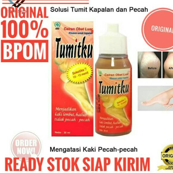 Jual TUMITKU OBAT HERBAL MENGATASI KAKI PECAH PECAH ISI 60ML ORIGINAL ...