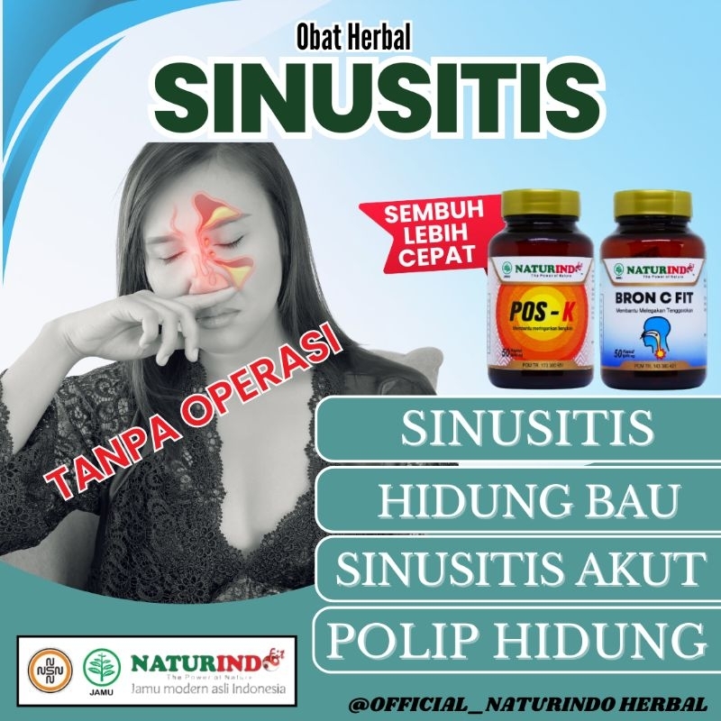 Jual Obat Sinusitis Polip Hidung Menahun Hidung Bau Busuk Paling Ampuh ...