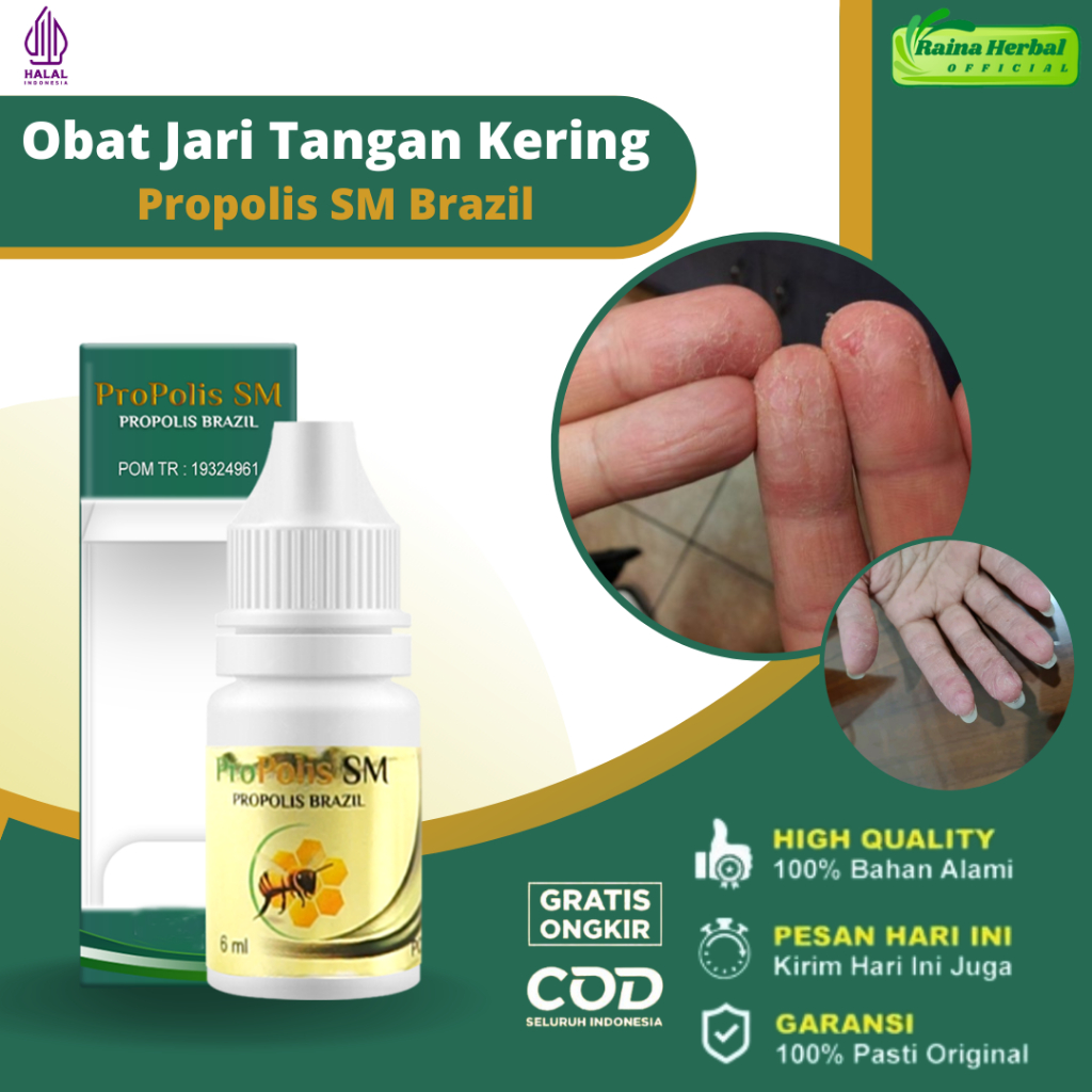 Jual Obat Jari Tangan Kering, Obat Telapak Tangan Kasar, Obat Tangan ...