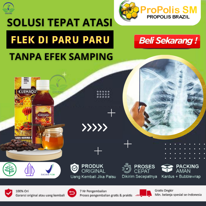 Jual Obat Flek Paru Paru, Paru Paru Basah, Bronkitis Kronis, Batuk ...