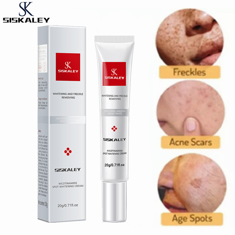 Jual Whitening Freckle Cream Remove Dark Spots Anti Freckle Cream Niacinamide Fade Pigmentation ...