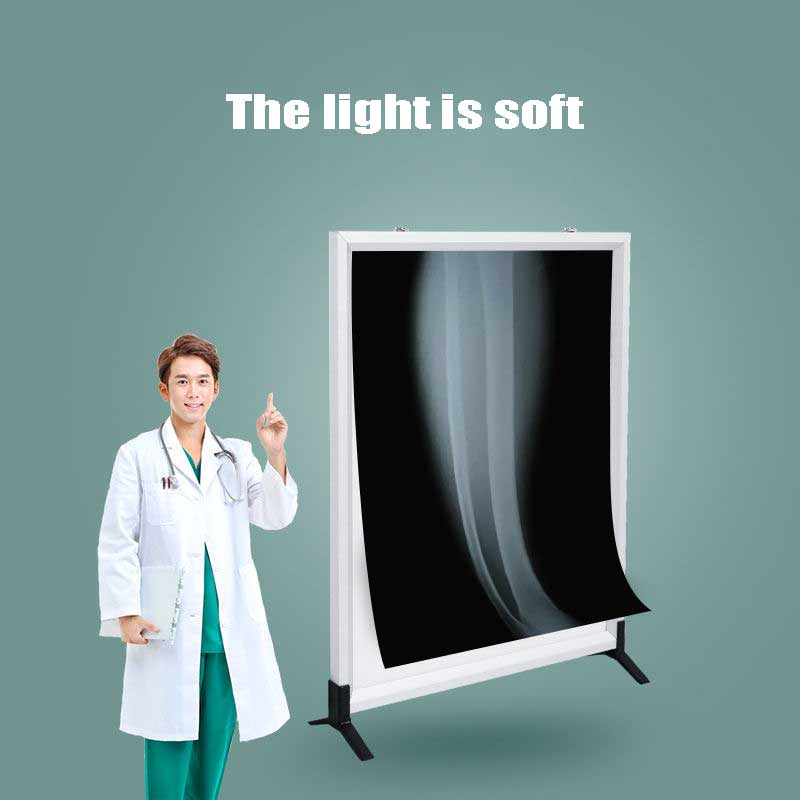 Jual X Ray Viewer Light Box X-Ray Lampu Baca Ronsen Rontgen Gigi ...
