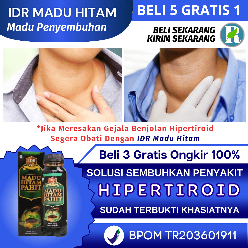 Jual IDR Madu Hitam Obat Hipertiroid 350 gram | Shopee Indonesia