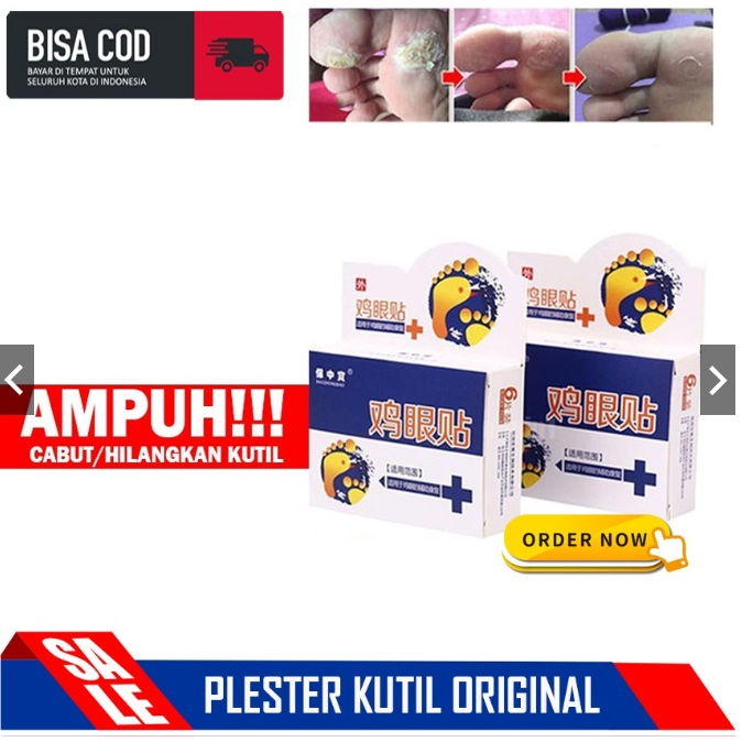 Jual Plaster Kutil Obat Mata Ikan Ji Yan Gao Calusol Obat Mata Ikan ...