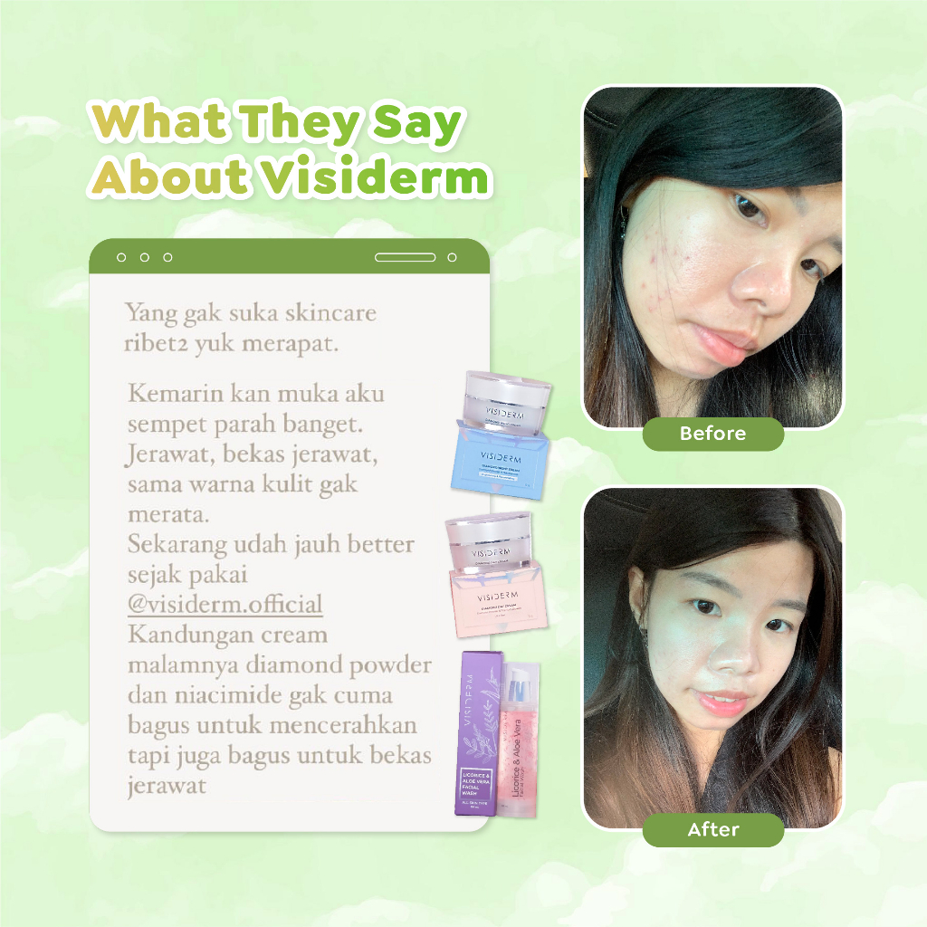 Jual VISIDERM - Bundling Day & Night cream | Shopee Indonesia