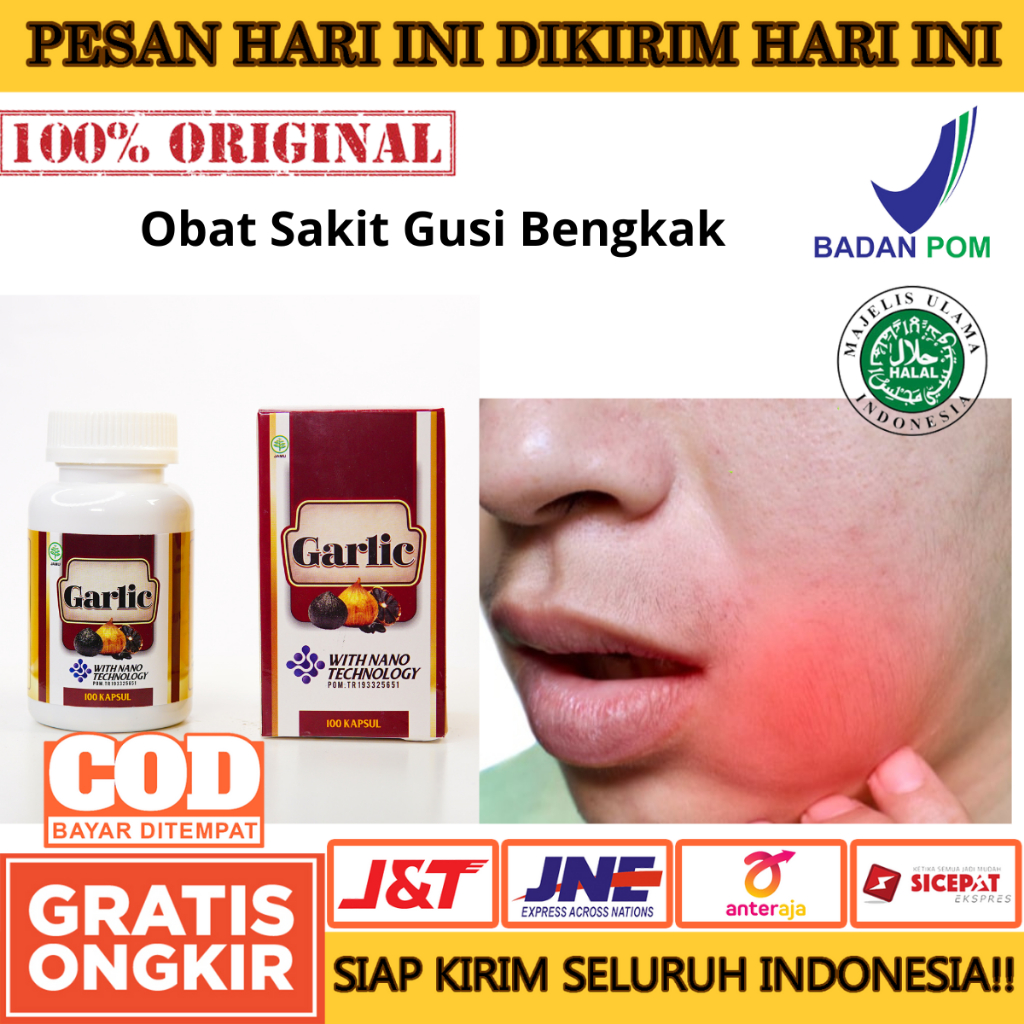 Jual Obat Sakit Gusi Bengkak, Sariawan, Benjolan Di Ketiak, Bisul ...