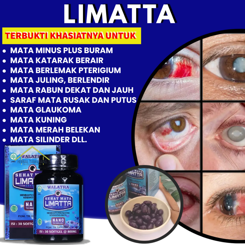 Jual Obat Mata juling anak dan dewasa - Mata juling sebelah, Deleng, Juling Mata Dengan Limatta ...