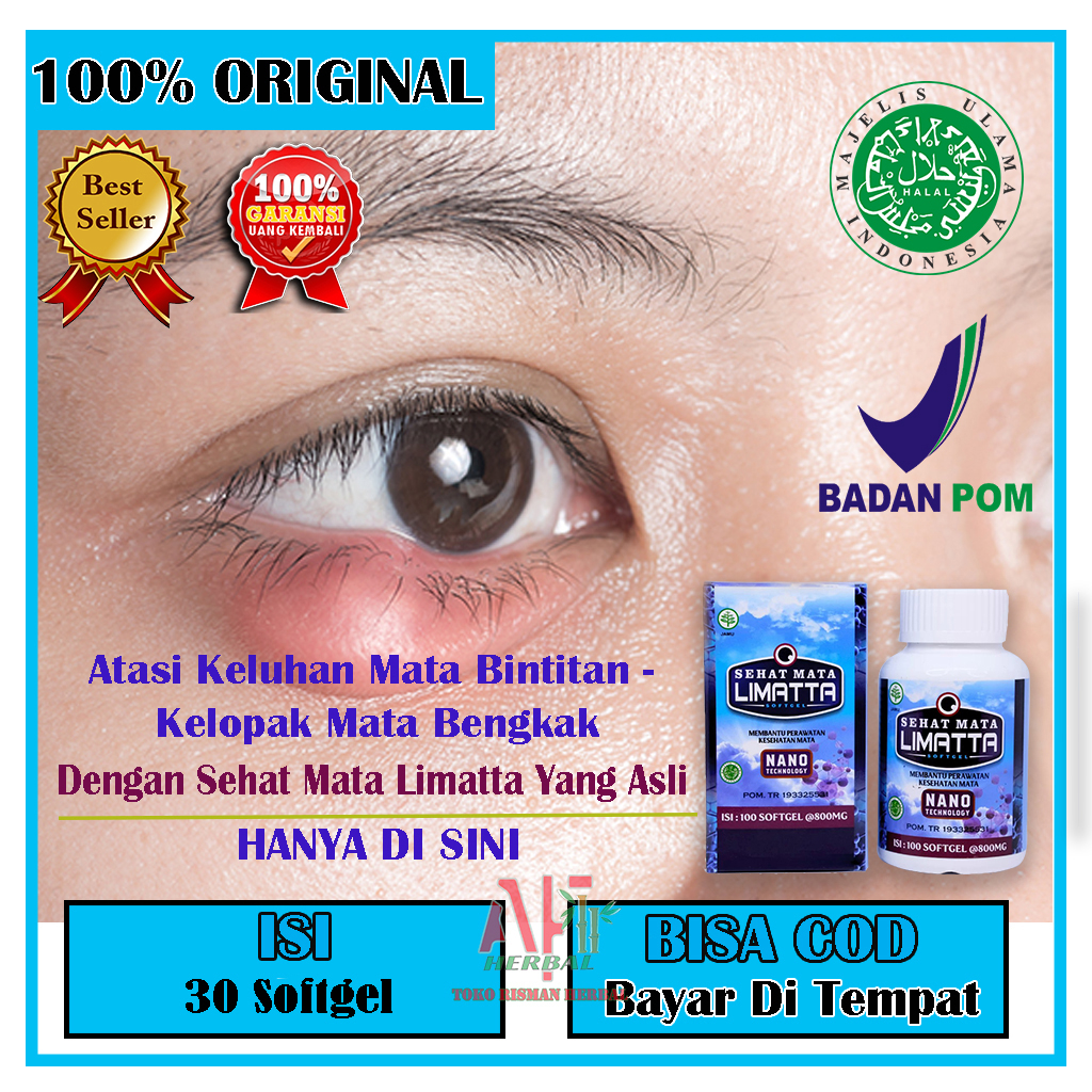 Jual Obat Mata Bintitan - Kelopak Mata Bengkak dan Nyeri Sehat Mata ...