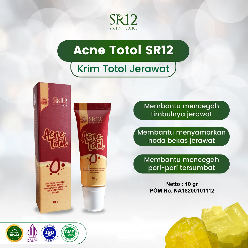 Jual Acne Totol Cream SR12 - Krim Totol Treatment Jerawat - Menghilangkan Jerawat, Menyamarkan ...