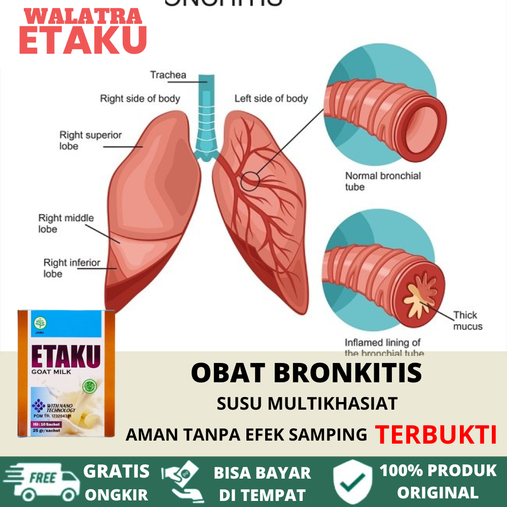 Jual Obat Bronkitis Kronis, Batuk Parah, Batuk Menahun, Batuk Berdarah ...