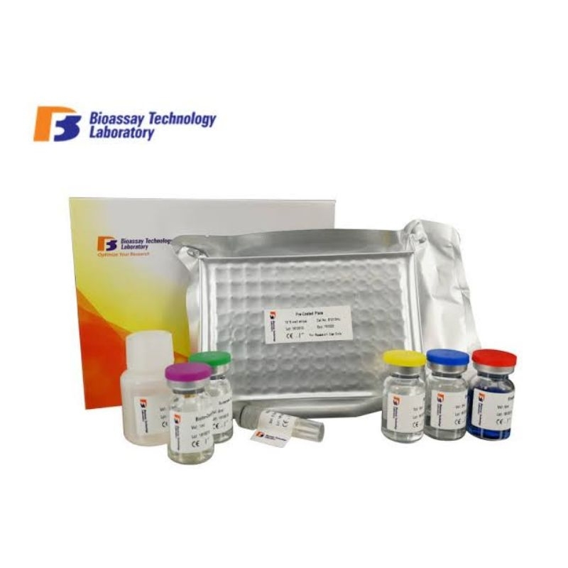 Jual Human TOX-IgG (Toxoplasma-Immunoglobulin G) ELISA Kit | Shopee ...