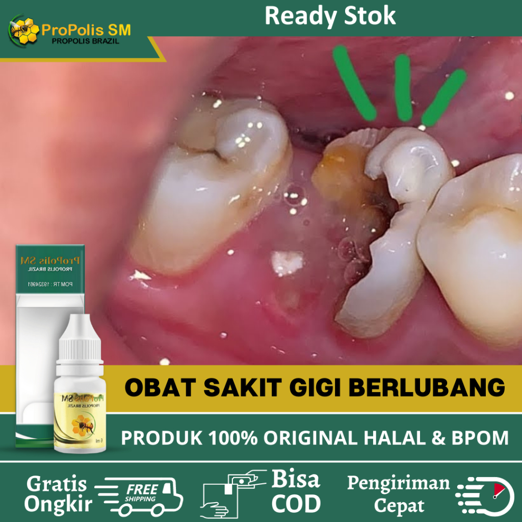 Jual Obat Sakit Gigi, Obat Sakit Gigi Berlubang, Sakit Gigi Linu, Sakit ...
