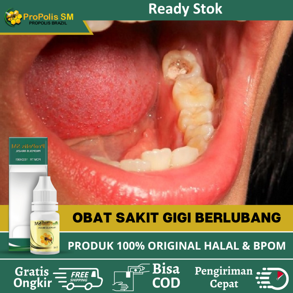 Jual Obat Sakit Gigi Berlubang, Sakit Gigi Dan Gusi, Gigi Nyut Nyutan, Sakit Gigi Linu, Sakit ...