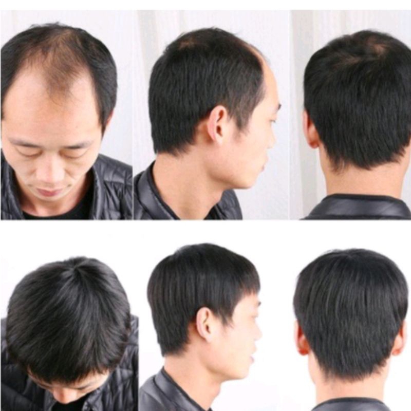 Jual Hairtop Pria Pendek Lurus Toupee Penutup Botak Model Rambut Pendek ...
