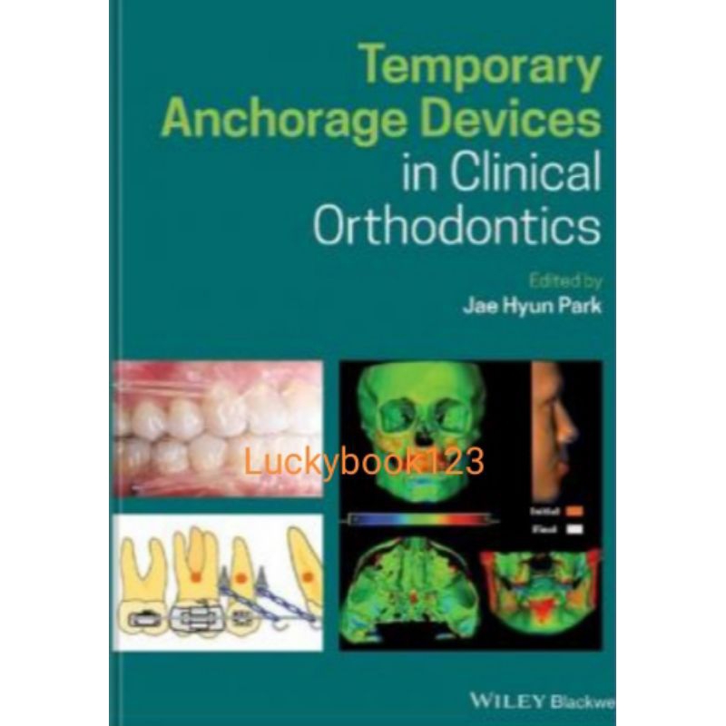 Jual Buku Temporary Anchorage Devices in Clinical Orthodontics by Jae ...