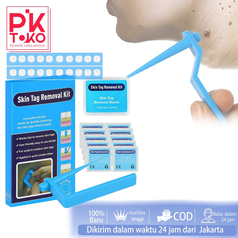 Jual Obat Kutil Penghilang Tahi Lalat Skin Tag Mole Wart Remover Tools ...