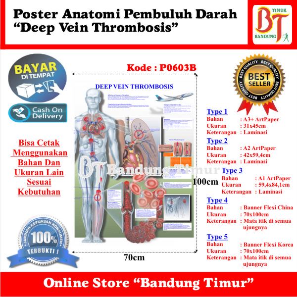 Jual POSTER ANATOMI PEMBULUH DARAH - DEEP VEIN THROMBOSIS | Shopee ...
