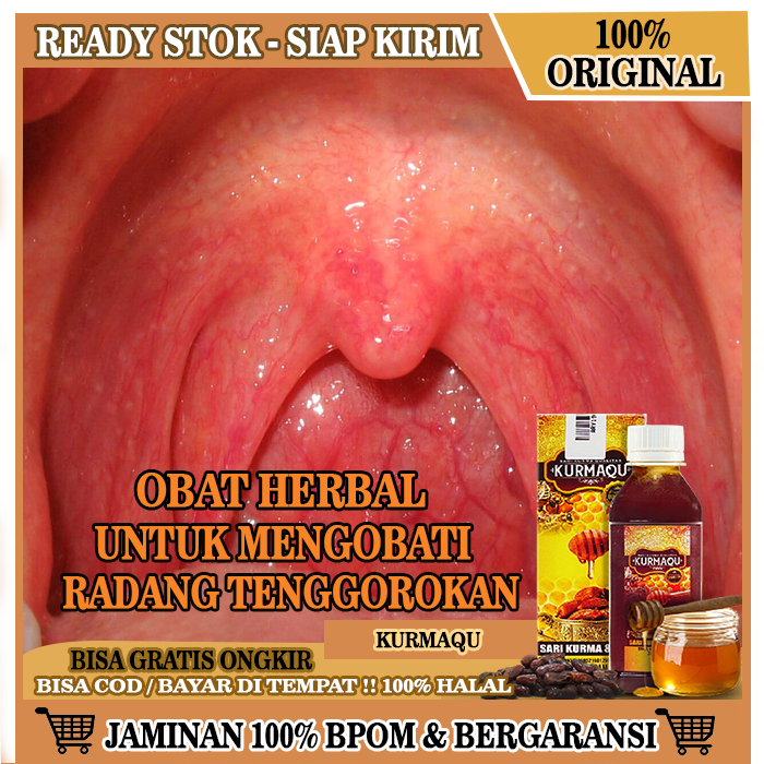 Jual Obat Buat Radang Amandel, Obat Amandel, Obat Tenggorokan Perih ...